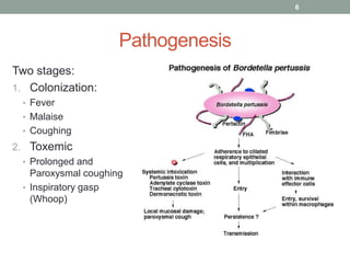 Pertusis (Whooping cough) by Sunil Kumar Daha | PPT