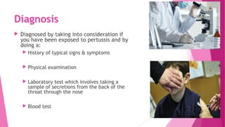 Pertussis ( whooping cough)..Bordetella pertussis ... | PPT
