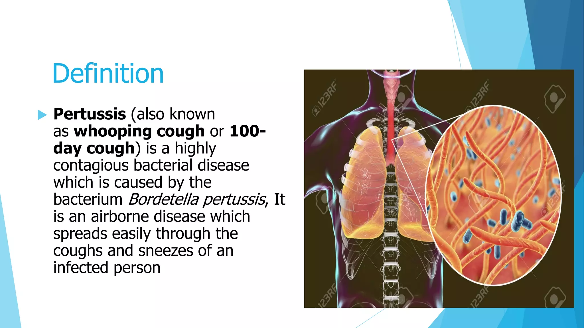 Pertussis | PDF | Ear, Nose and Throat Conditions | Diseases and Conditions