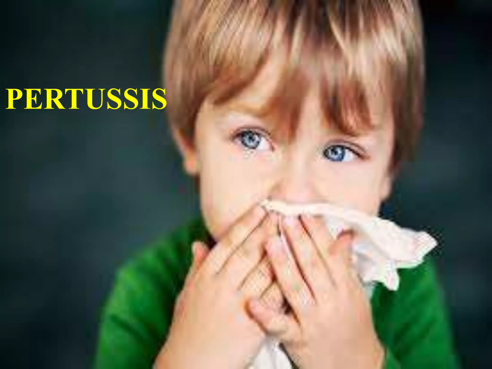 Pertussis | PPT