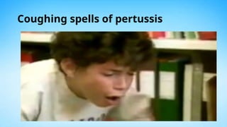 PERTUSSIS- etiology, complications, management pptx | PPTX