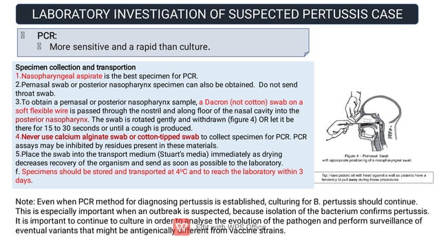 Pertussis : what should we know? Primary care | PPT