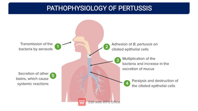 Pertussis : what should we know? Primary care | PPT