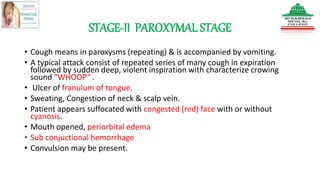 Epidemiology and Control Measure for Pertussis whooping c | PPTX