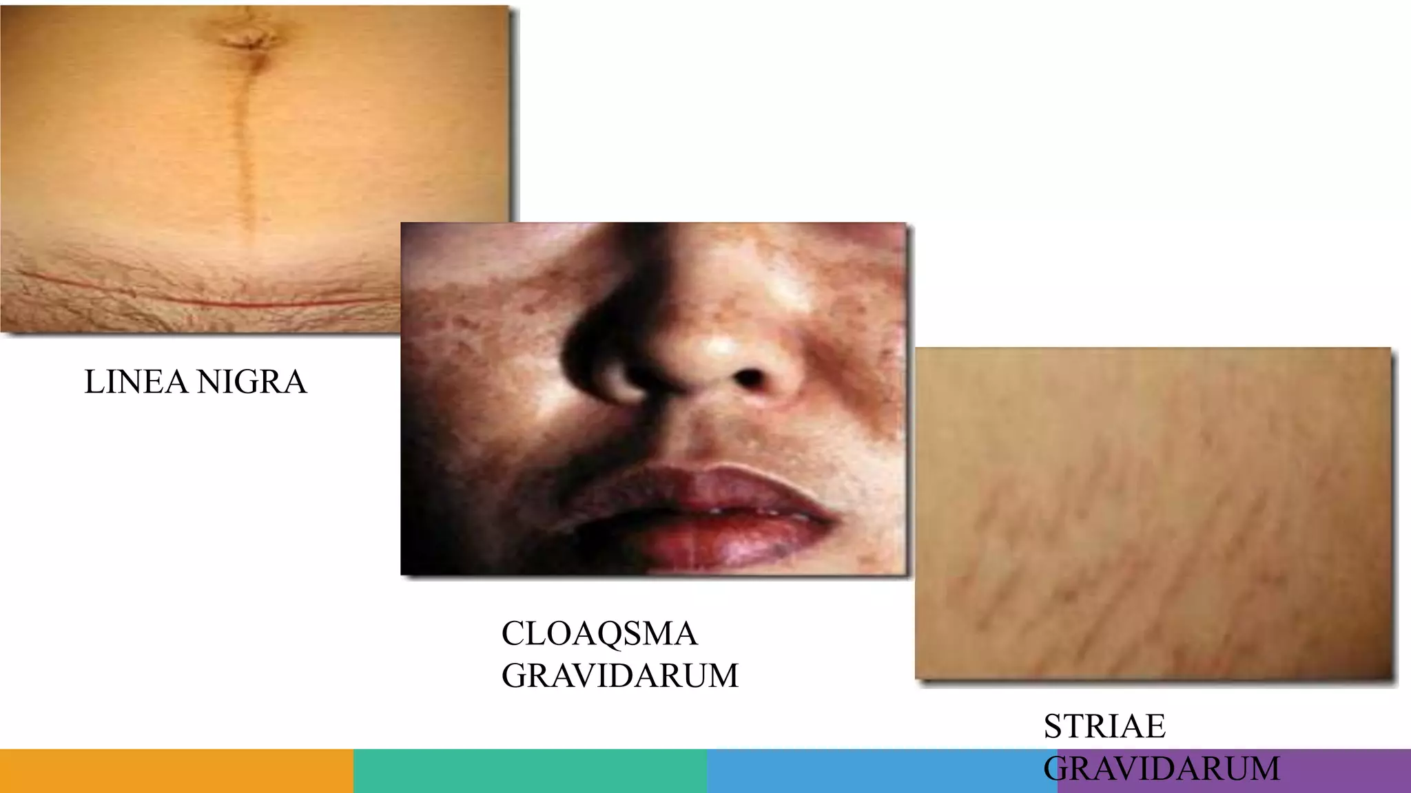 Perubahan Anatomi dan Adaptasi Fisiologi Kehamilan | PPTX