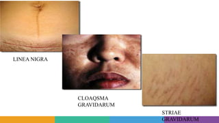 Perubahan Anatomi dan Adaptasi Fisiologi Kehamilan | PPT