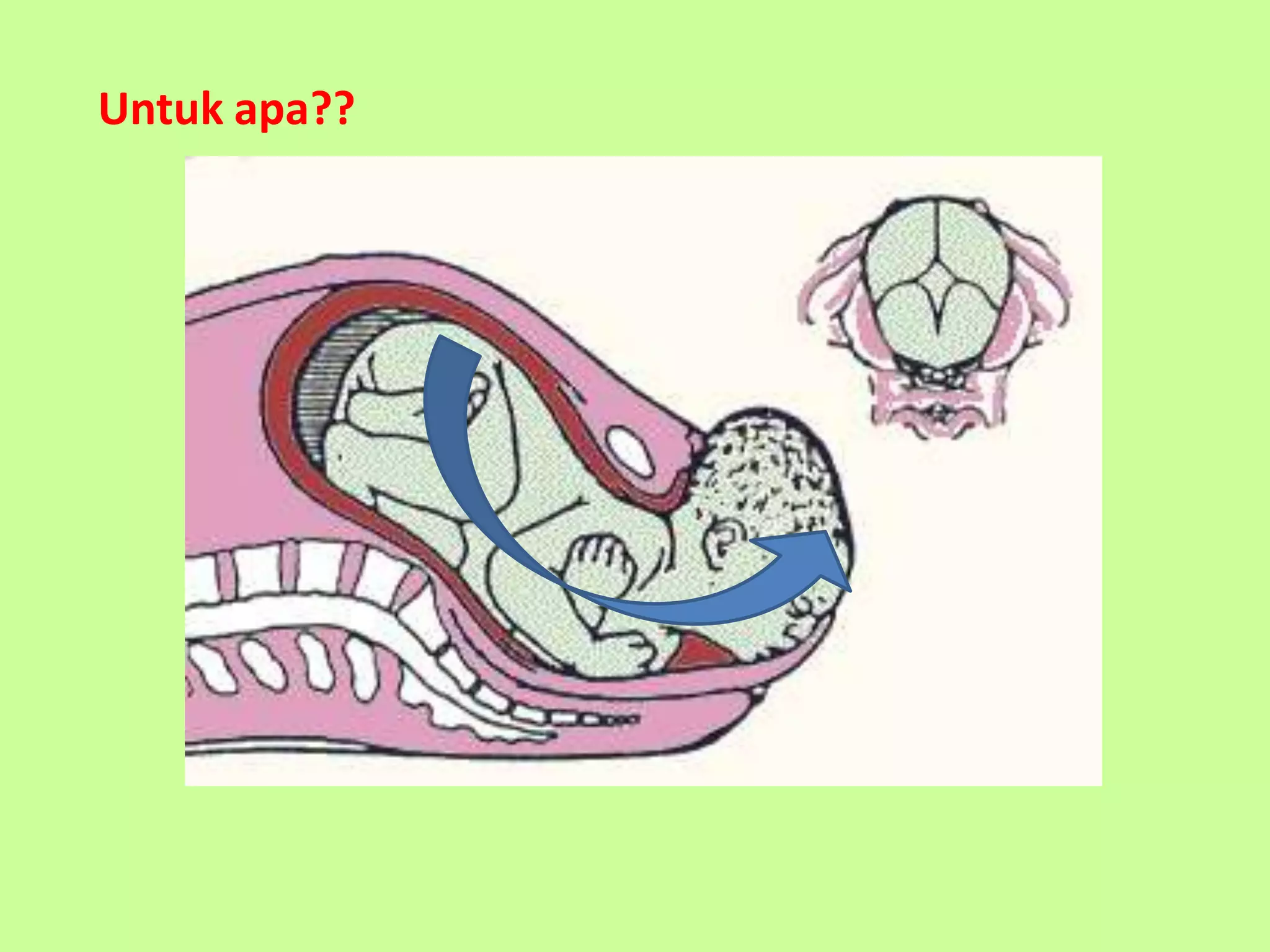 Perubahan persalinan, 3 pP f | PPT
