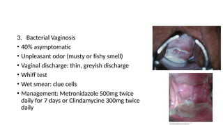 Pervaginal discharge & menstrual disorder.pptx