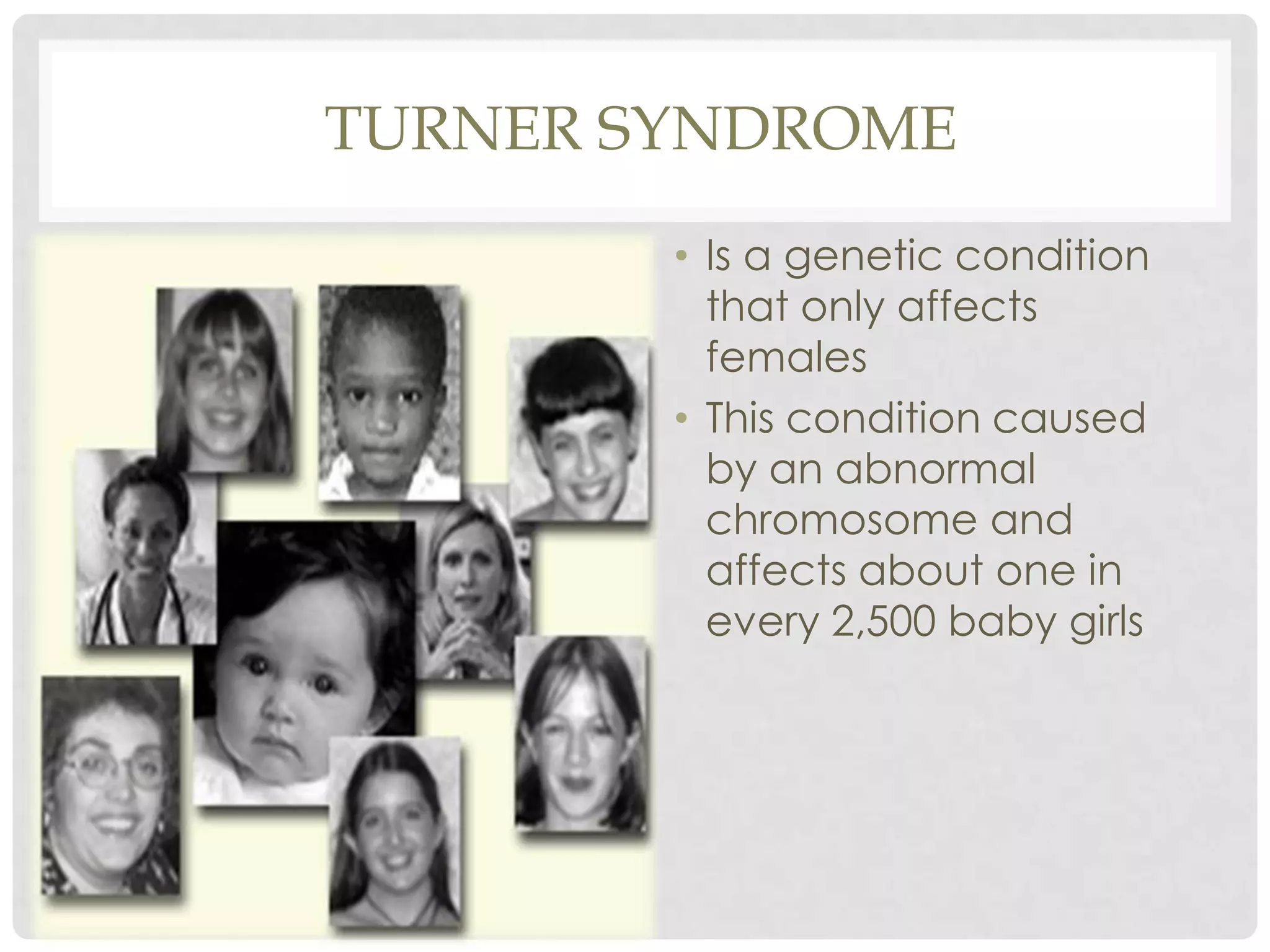 Pervasive developmental disorders (turner syndrome, klinefelter's ...