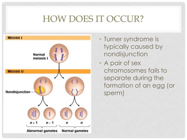 Pervasive developmental disorders (turner syndrome, klinefelter's ...