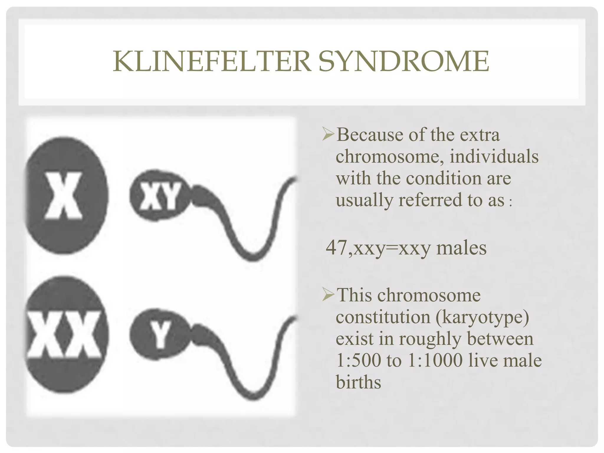 Pervasive developmental disorders (turner syndrome, klinefelter's ...
