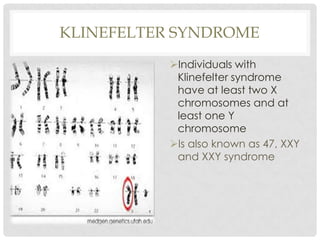 Pervasive developmental disorders (turner syndrome, klinefelter's ...