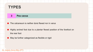 Pes cavus.pdf