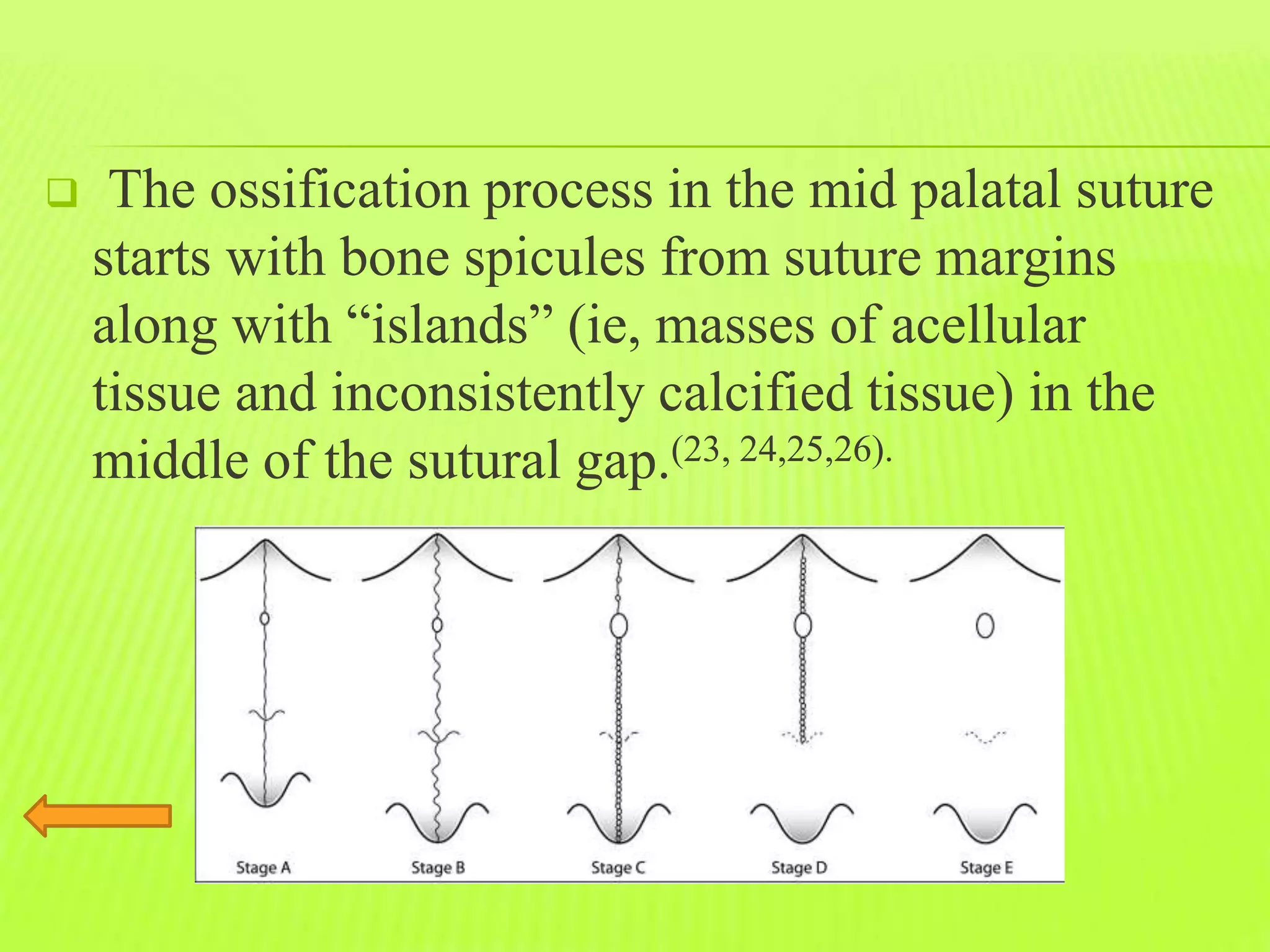 HOW to measure CBCT BEFORE AND AFTER MID PALATAL SUTURE OPENING | PPTX
