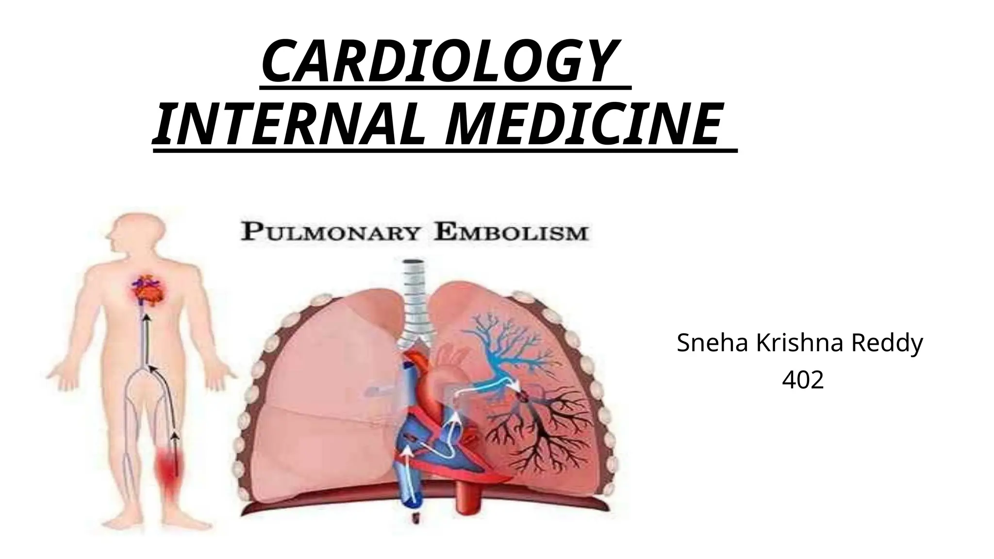 Pulmonary embolism in cardiology ppt .... | PPT
