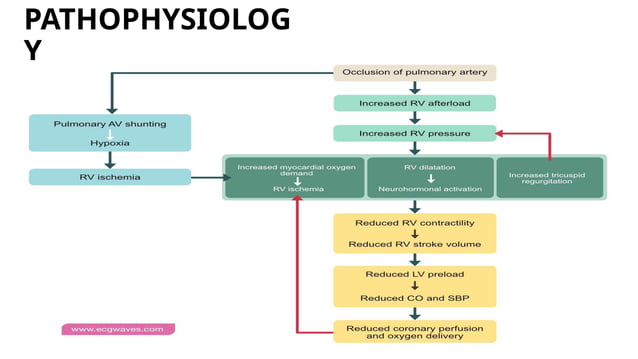 Pulmonary embolism in cardiology ppt .... | PPT