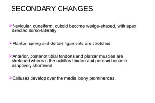 Pes planus | PPT