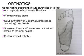 Pes planus | PPT