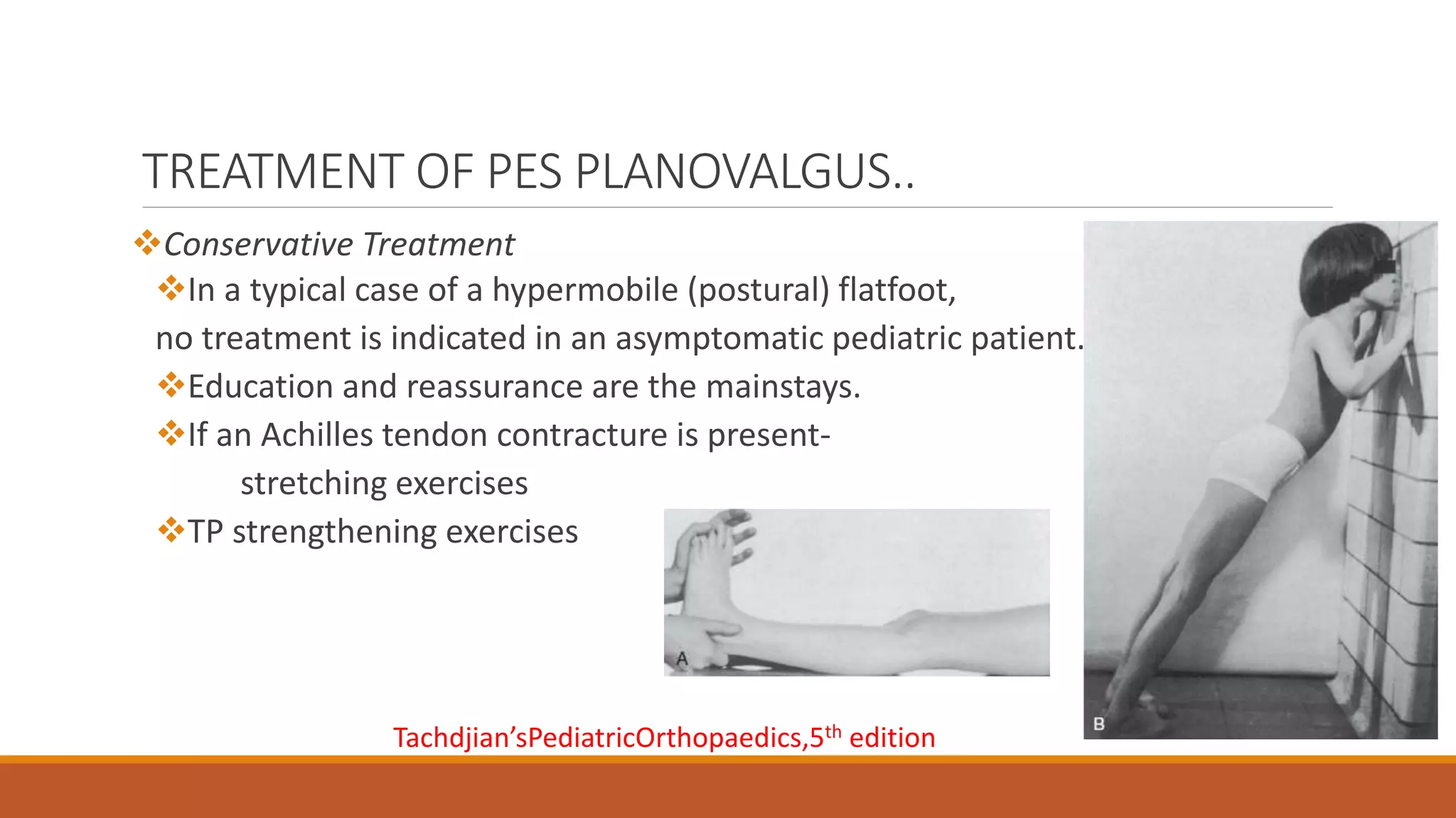 Pes planus | PPTX