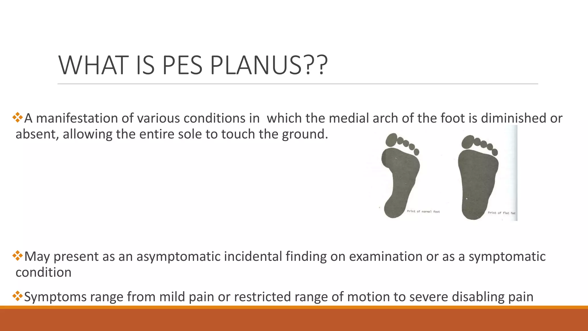 Pes planus | PPTX