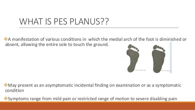 Pes planus