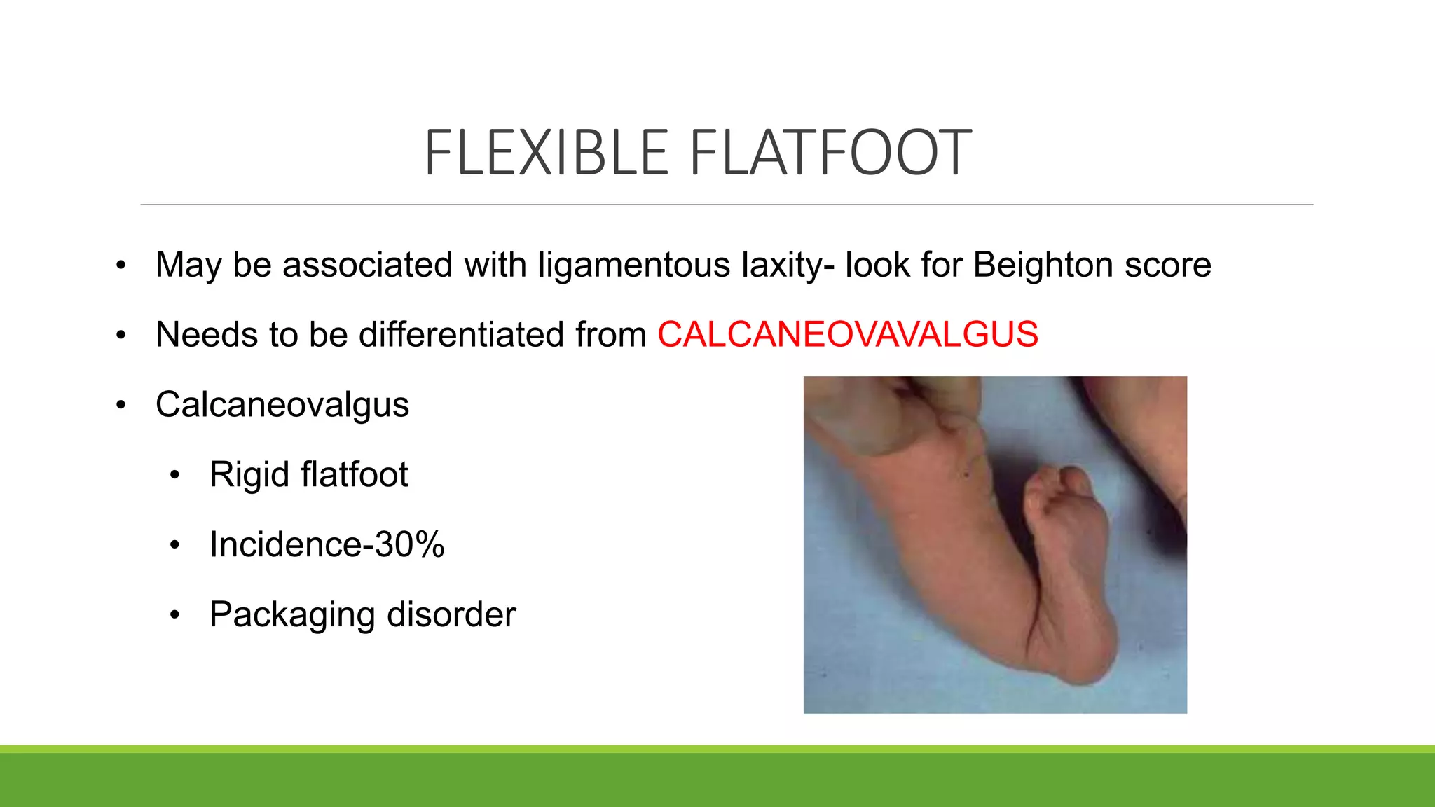 Pes planus and pes valgus | PPTX