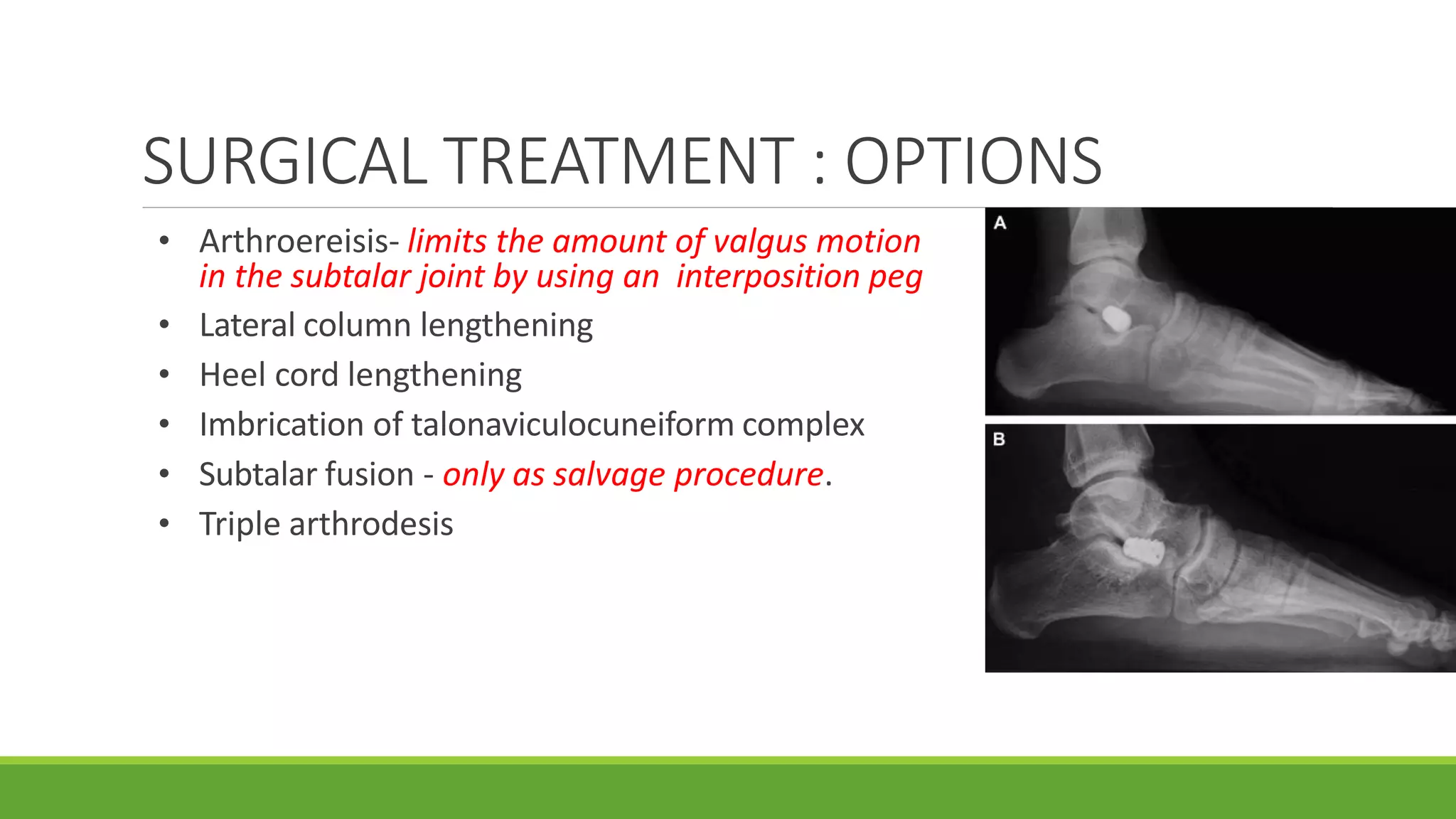 Pes planus and pes valgus | PPTX