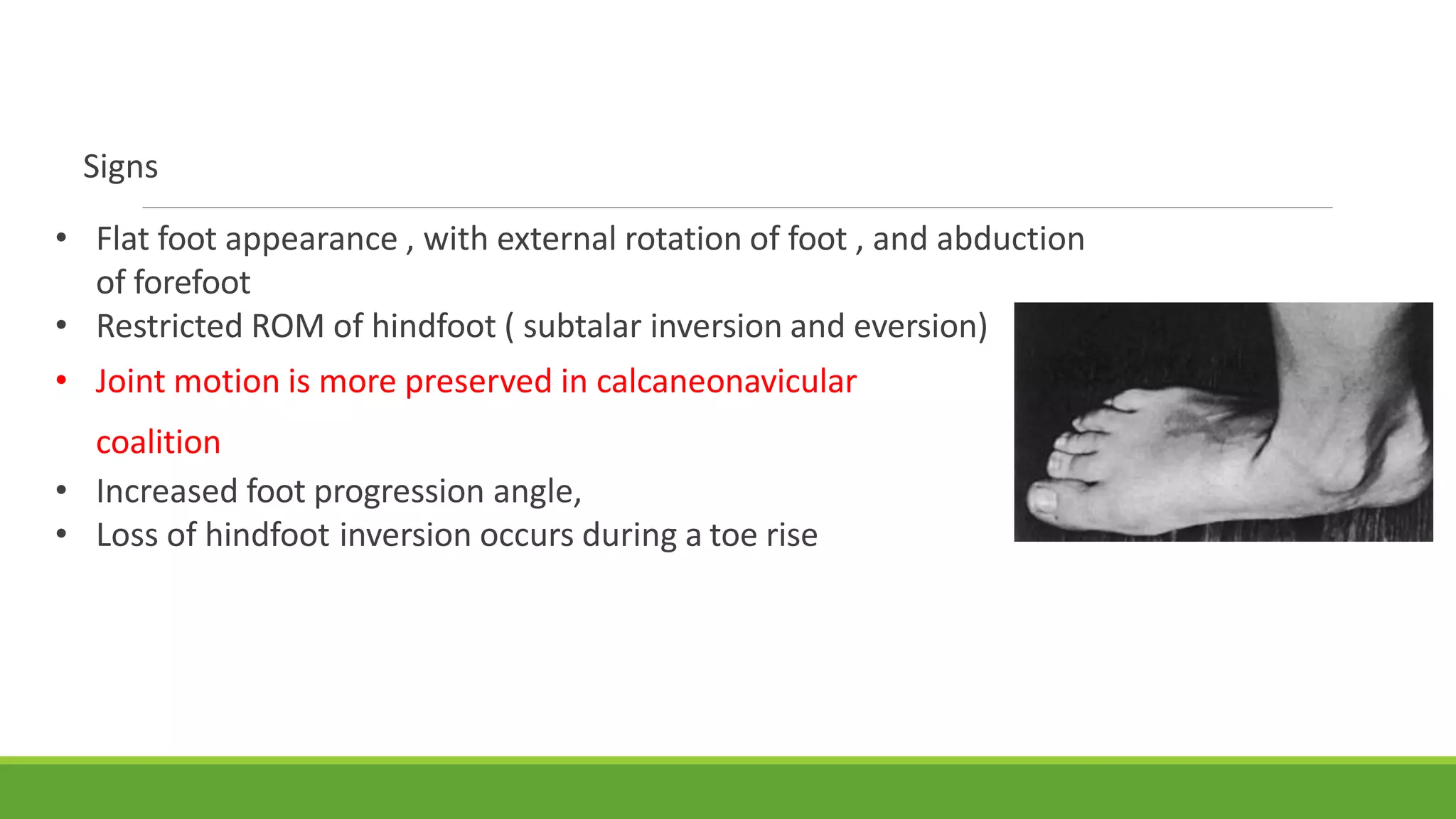 Pes planus and pes valgus | PPTX