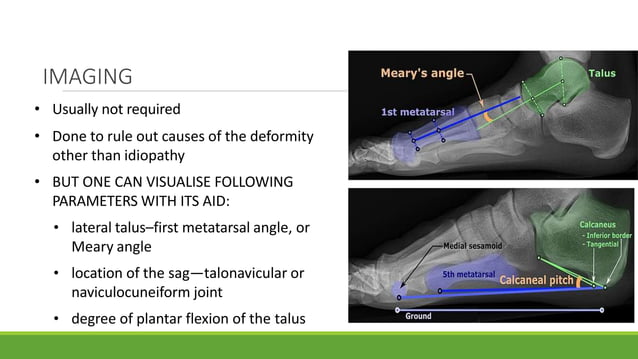 Pes planus and pes valgus | PPTX