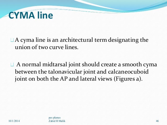 Pes plenovalgus dr zahid h malik