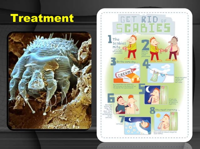 Predators: Bed Bugs, Scabies and more | PPTX | Infectious Diseases | Diseases and Conditions