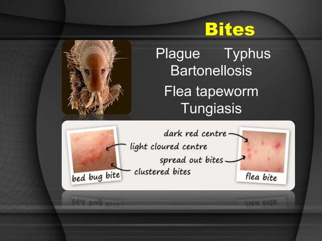 Predators: Bed Bugs, Scabies and more | PPTX | Infectious Diseases | Diseases and Conditions