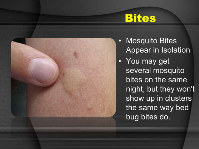 Predators: Bed Bugs, Scabies and more | PPTX | Infectious Diseases | Diseases and Conditions