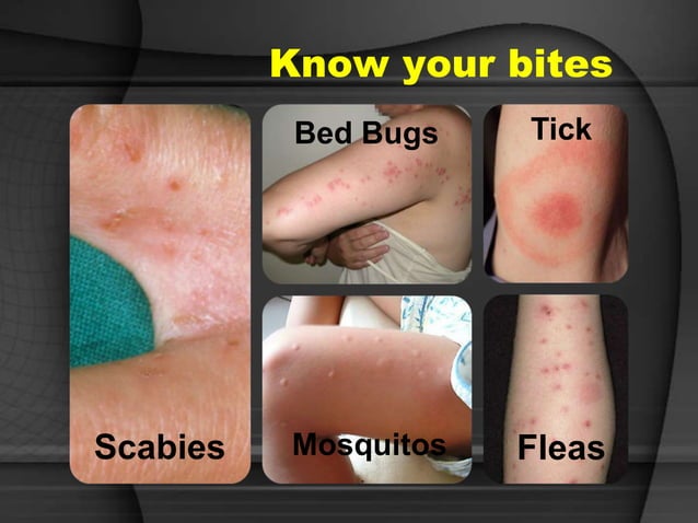 Predators: Bed Bugs, Scabies and more | PPTX | Infectious Diseases | Diseases and Conditions