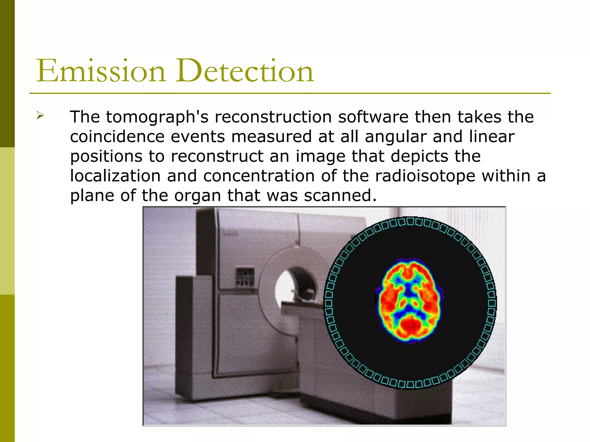 Positron Emission Tomography | PPT