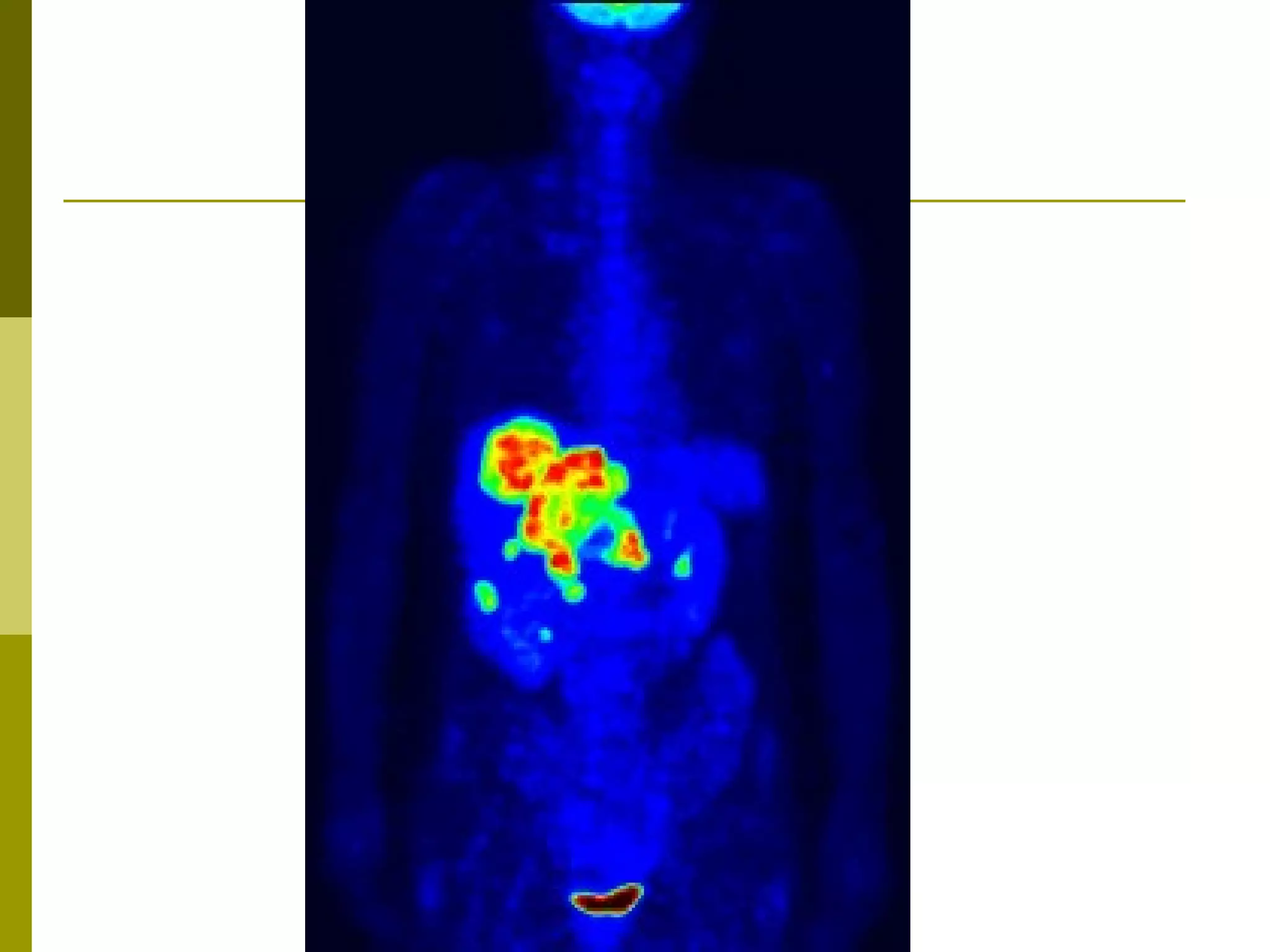 Positron Emission Tomography | PPT