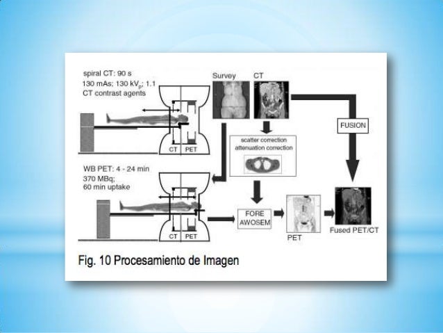 Tomografía por Emisión de Positrones (PET)