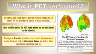 Positron Emission Tomography (PET).pdf