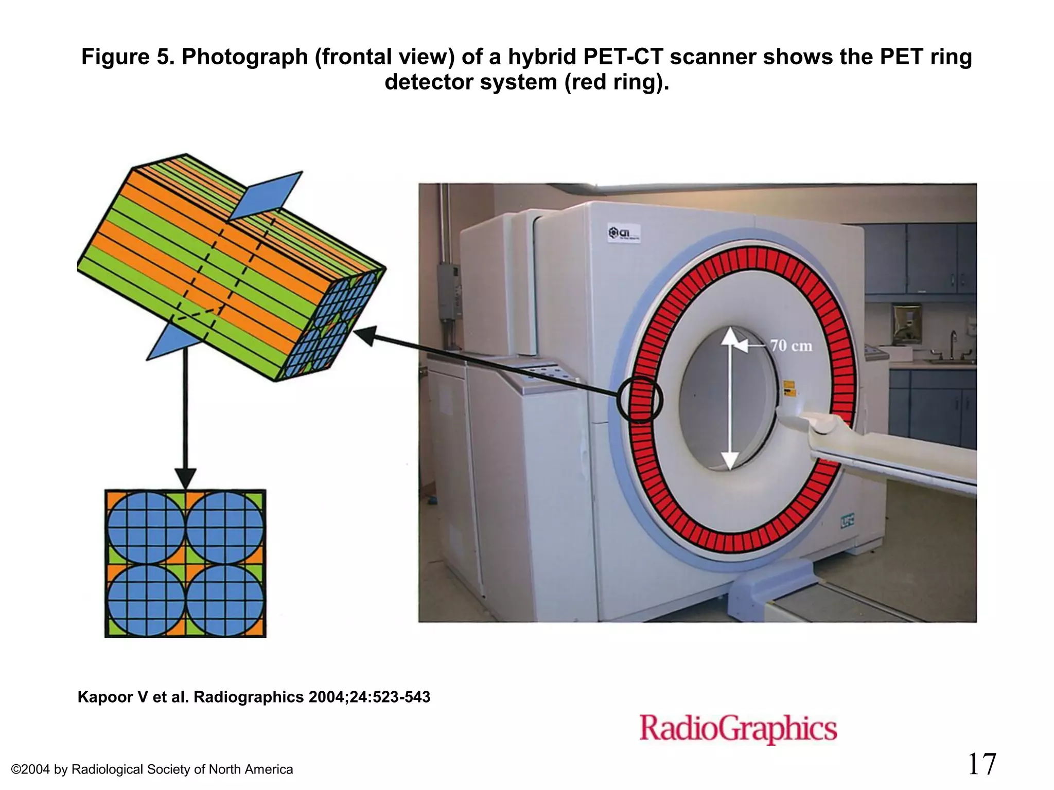 PET-CT Scan(Principles and Basics) | PDF