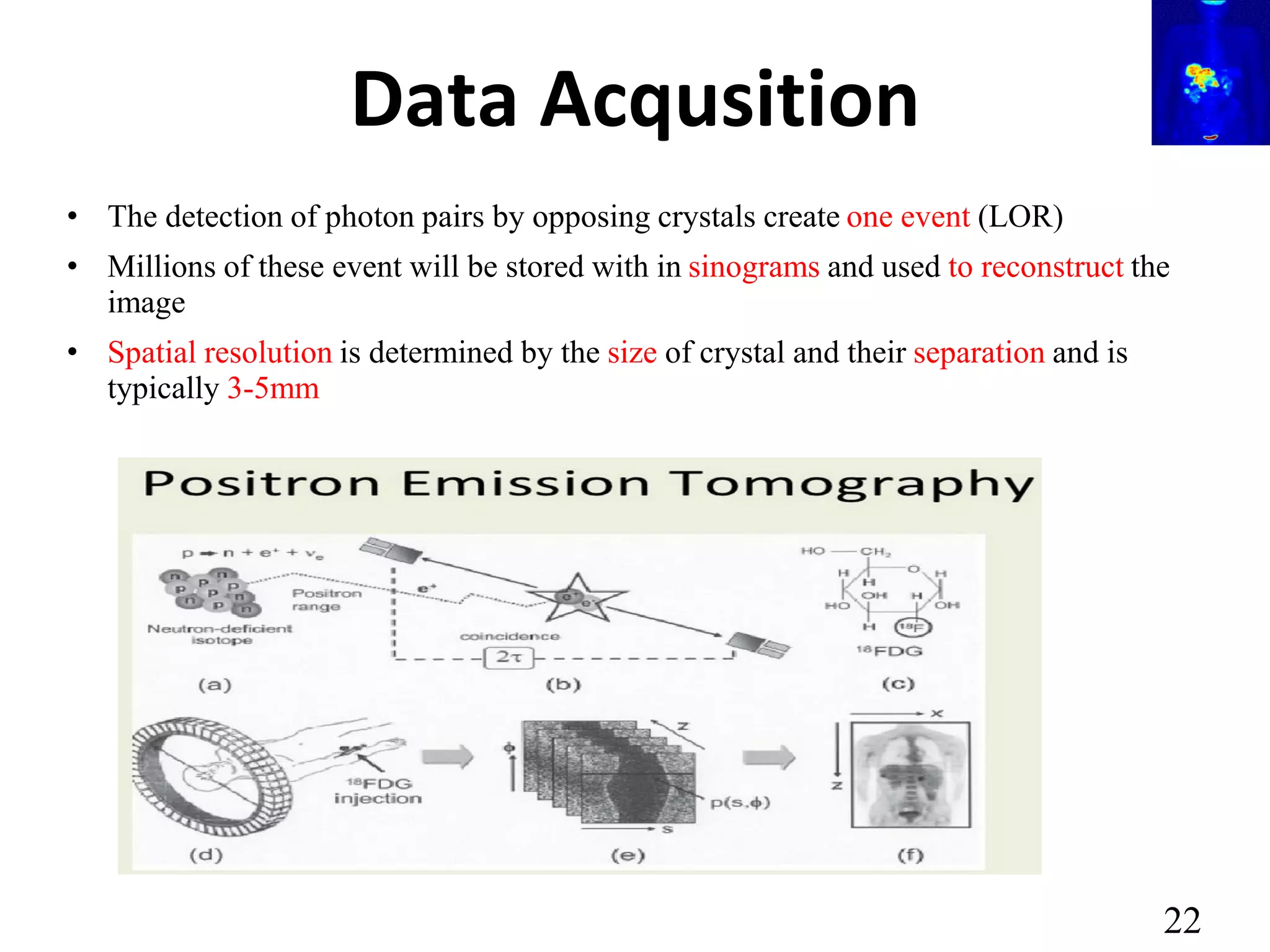 PET-CT Scan(Principles and Basics) | PDF