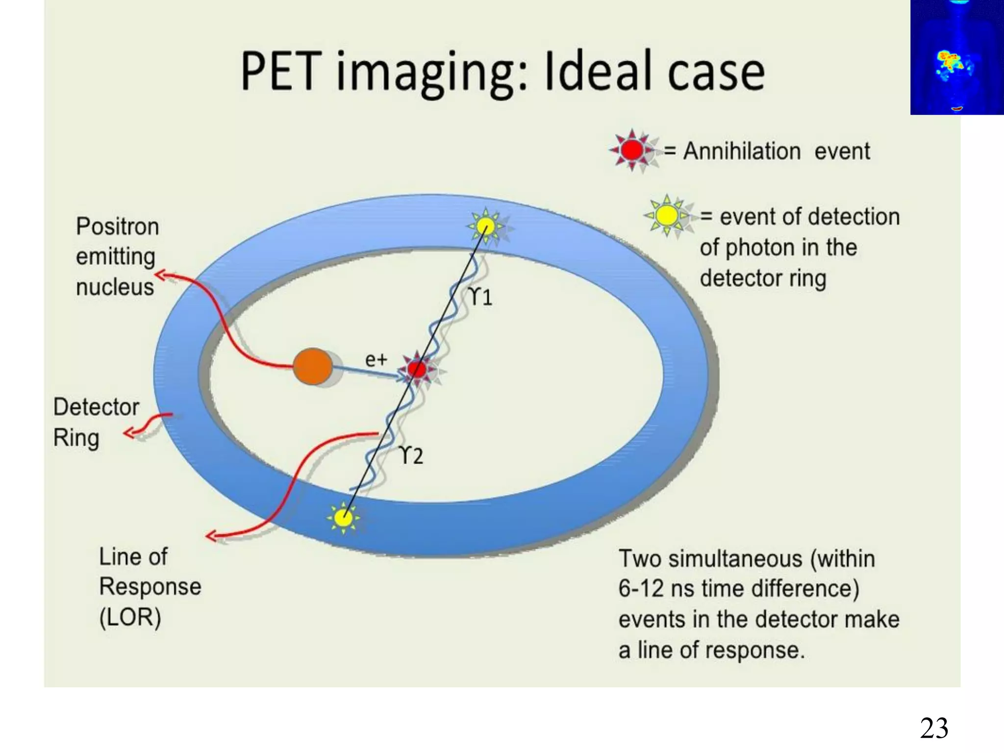 PET-CT Scan(Principles and Basics) | PDF