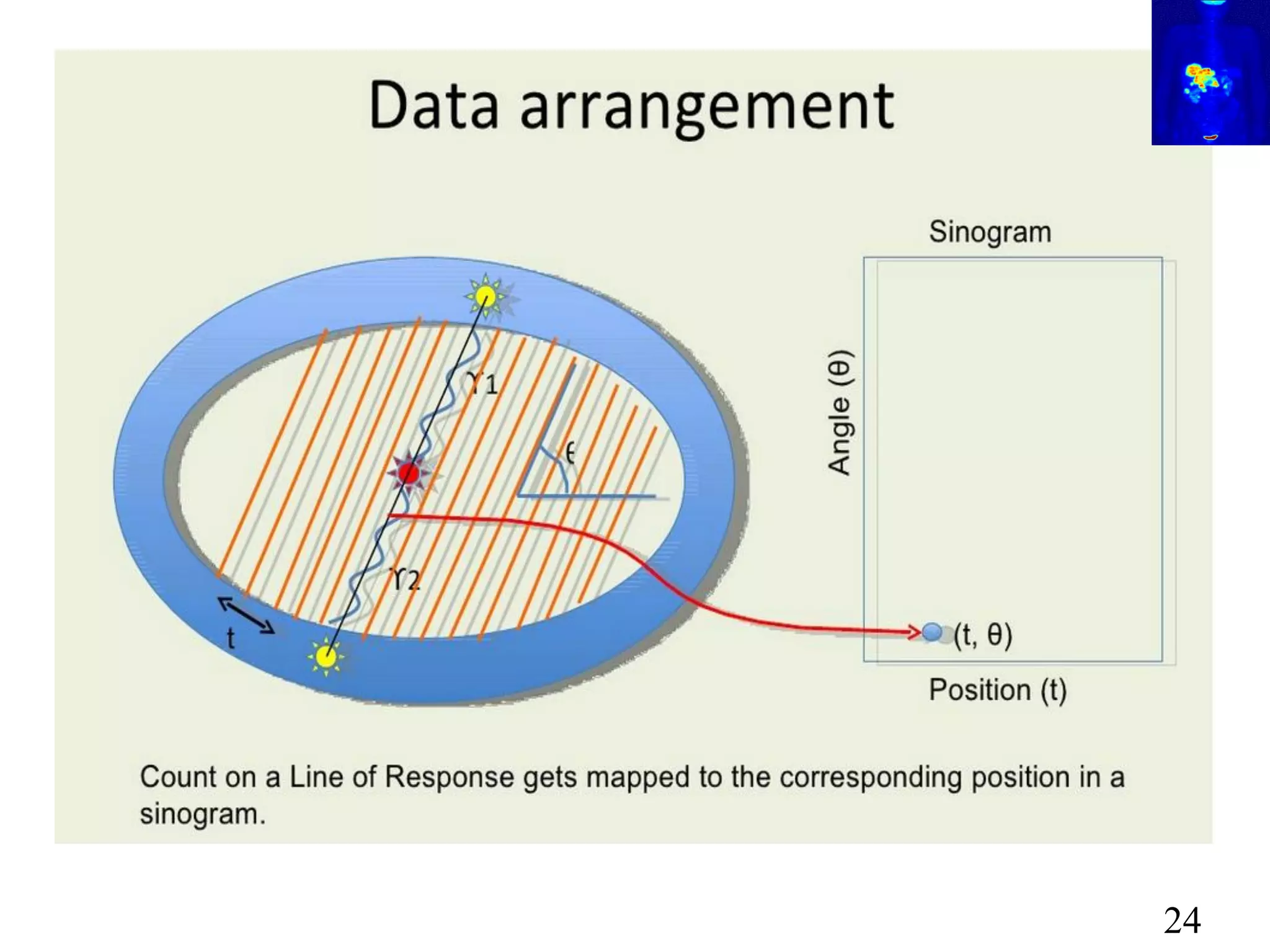 PET-CT Scan(Principles and Basics) | PDF
