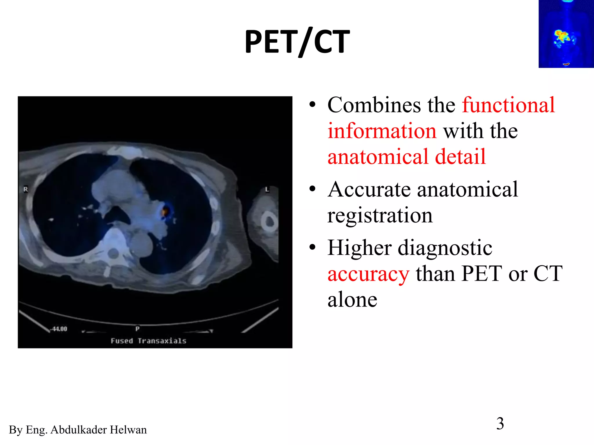 PET-CT Scan(Principles and Basics) | PDF