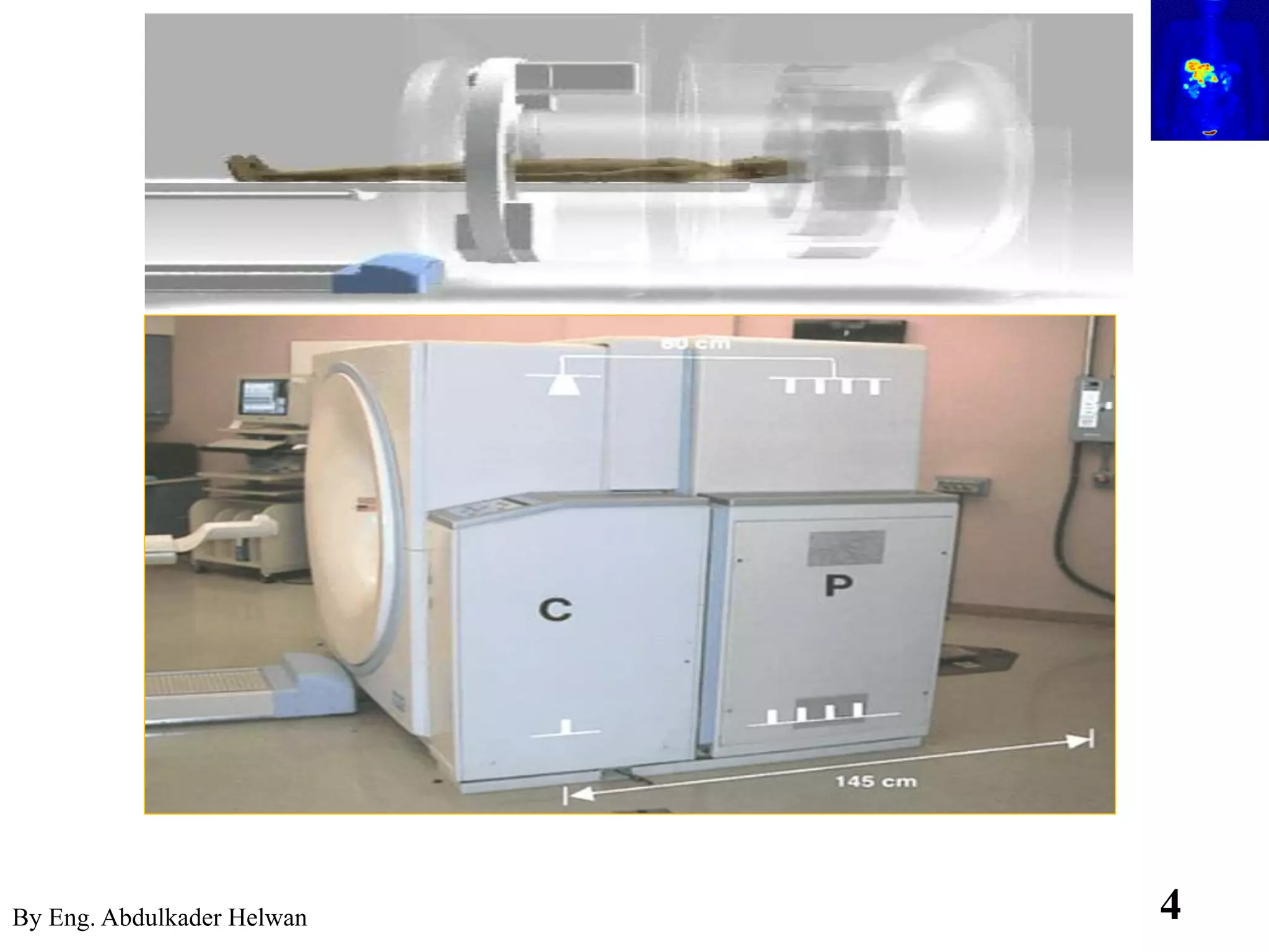 PET-CT Scan(Principles and Basics) | PDF