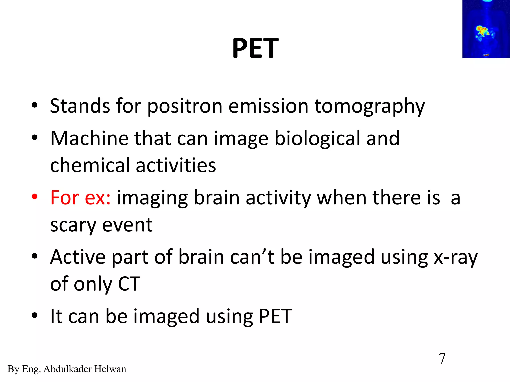 PET-CT Scan(Principles and Basics) | PDF