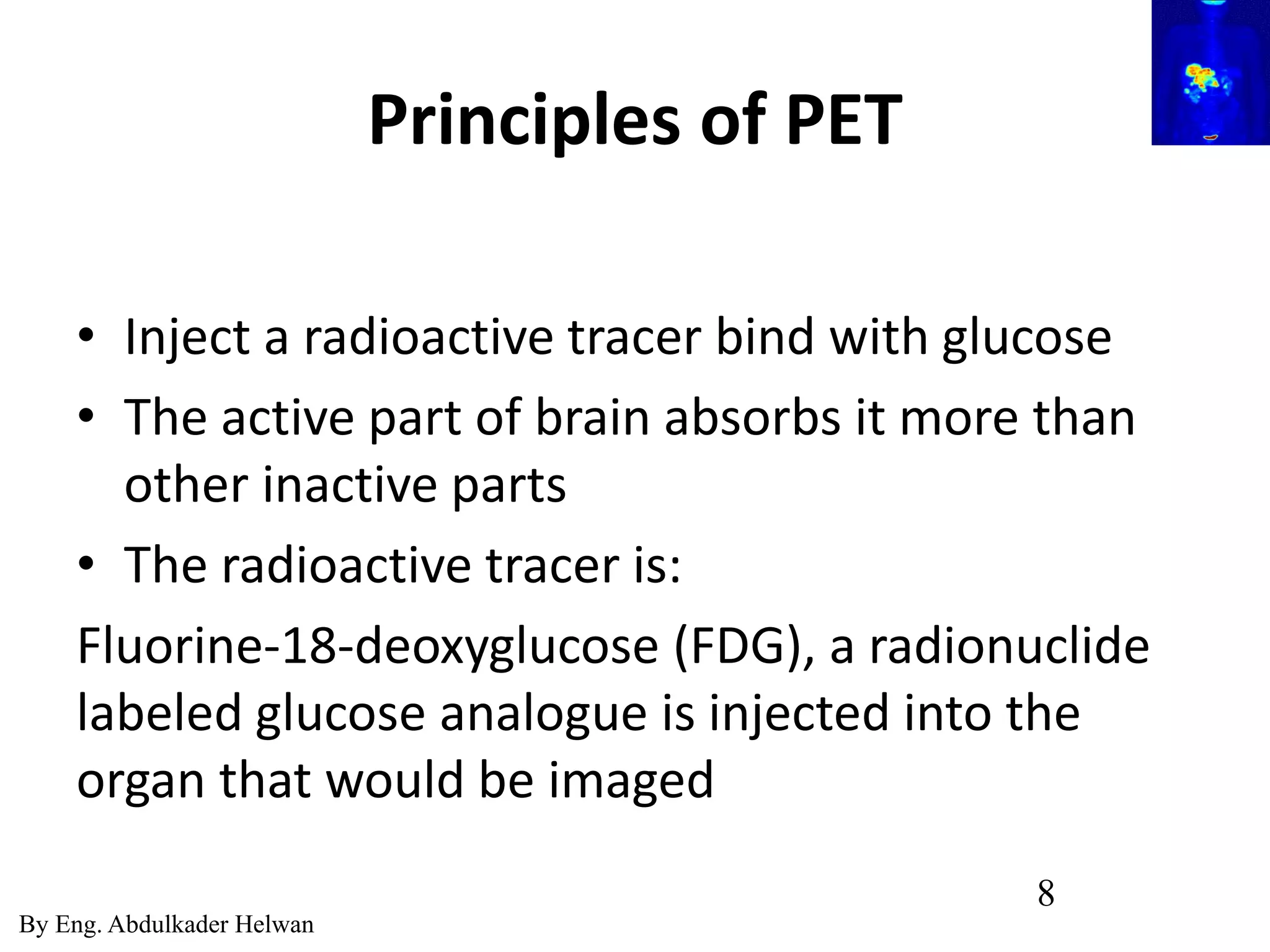 PET-CT Scan(Principles and Basics) | PDF