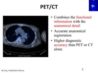 PET-CT Scan(Principles and Basics) | PDF
