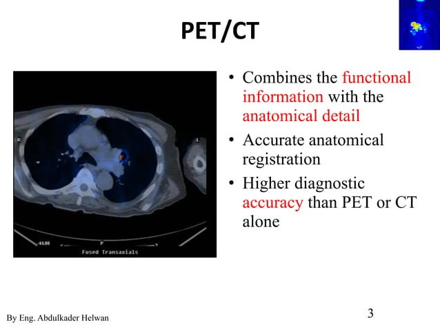 PET-CT Scan(Principles and Basics) | PDF | Lung and Respiratory Health ...