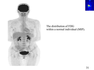 PET-CT Scan(Principles and Basics) | PDF