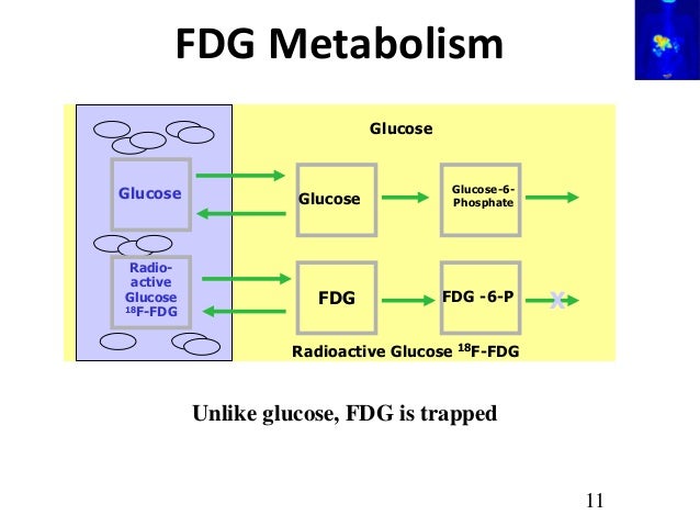 PET-CT Scan(Principles and Basics)